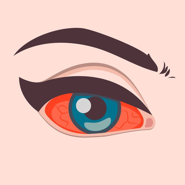 Surprising Causes & Symptoms of Eye Twitching – Dry Eye Mask